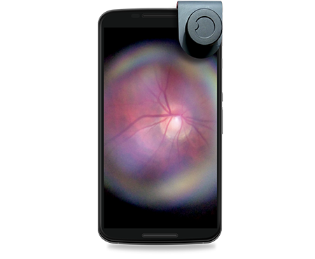 Innovate4Health: Eye Exams On-the-Go with PEEK – Center for ...